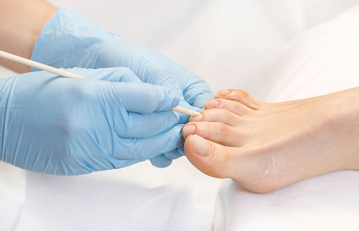 Foot Care – Fort St. John Pharmacy & Wellness Centre